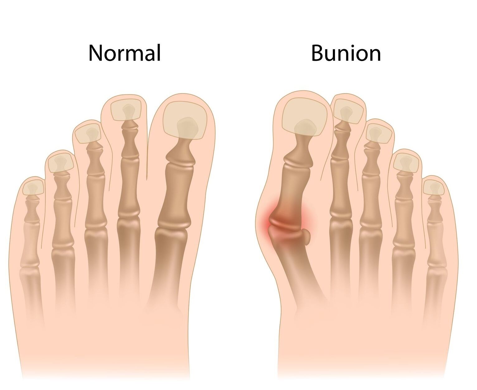Tucson Podiatrist – Desert Podiatric Medical Specialists